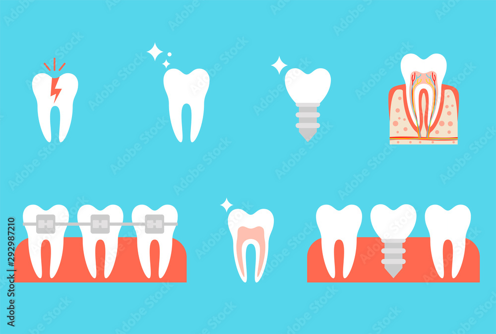 Correction of teeth with orthodontic braces. Tooth anatomy vector ...