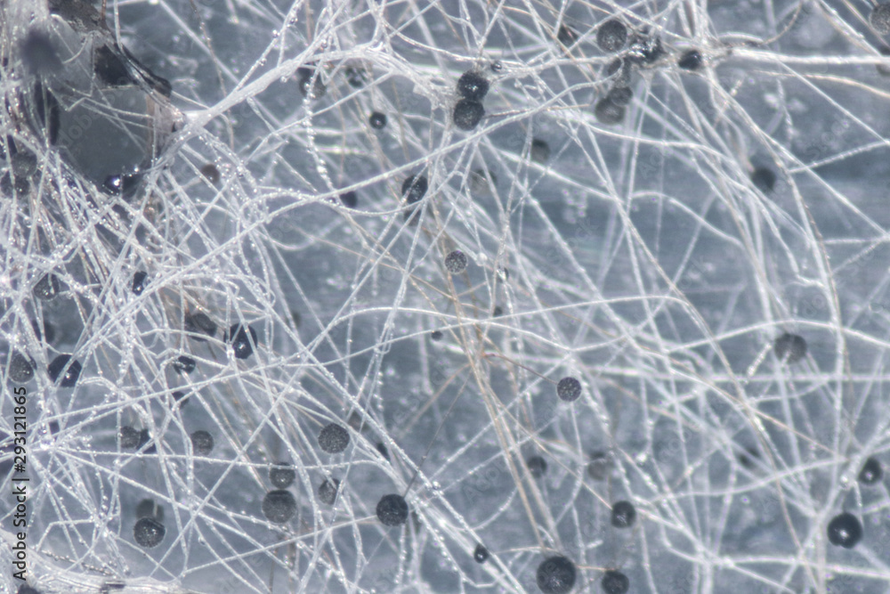 Rhizopus (bread mold) is a genus of common saprophytic fungi,Rhizopus ...