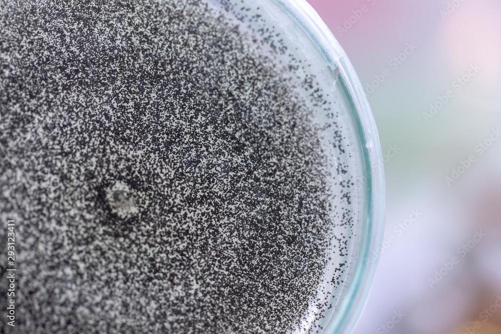 Rhizopus (bread mold) is a genus of common saprophytic fungi,Rhizopus ...