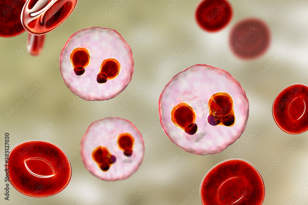 Stockillustratie The malaria-infected red blood cells. 3D illustration ...