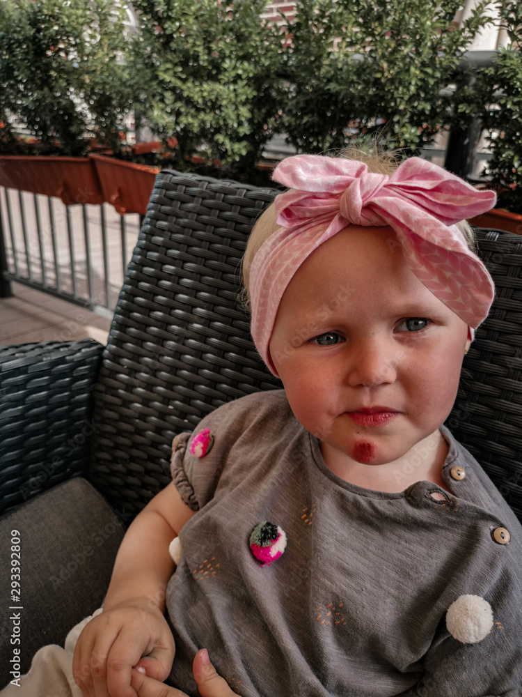 cute little girl with a bruise on her face sitting on rattan furniture ...
