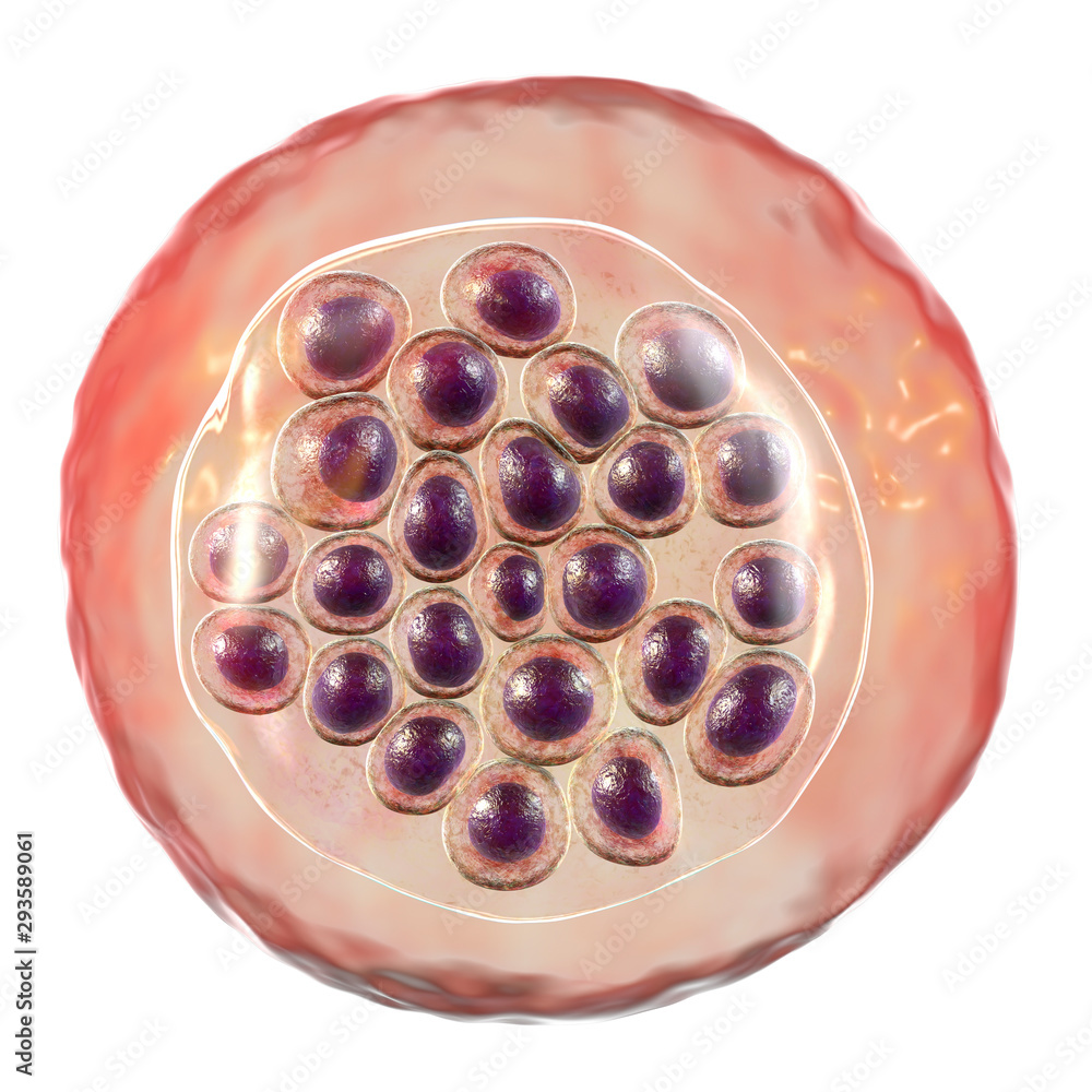 The malaria-infected red blood cell. 3D illustration showing malaria ...