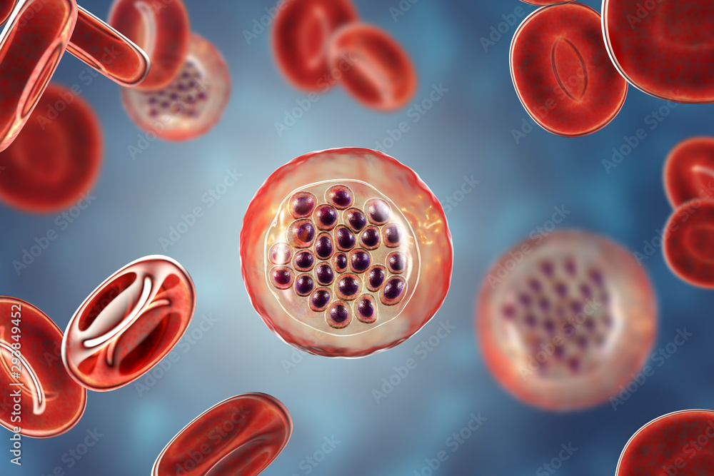 The malaria-infected red blood cells. 3D illustration showing malaria ...