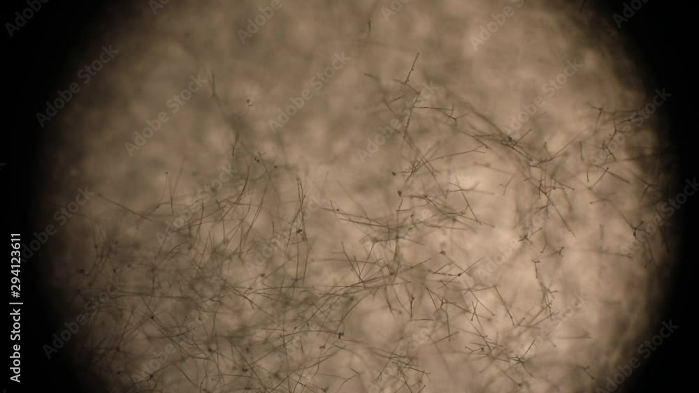 Botrytis cinerea hypae seen through an optical microscope in a ...