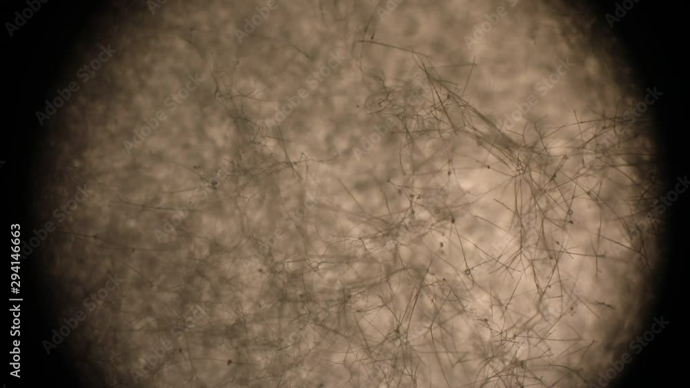 Mold mycelium Botrytis cinerea grown in agar in a plant biology ...