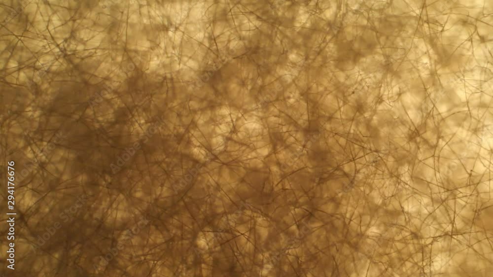 Botrytis cinerea mycelium grown in agar in the laboratory Stock ビデオ ...