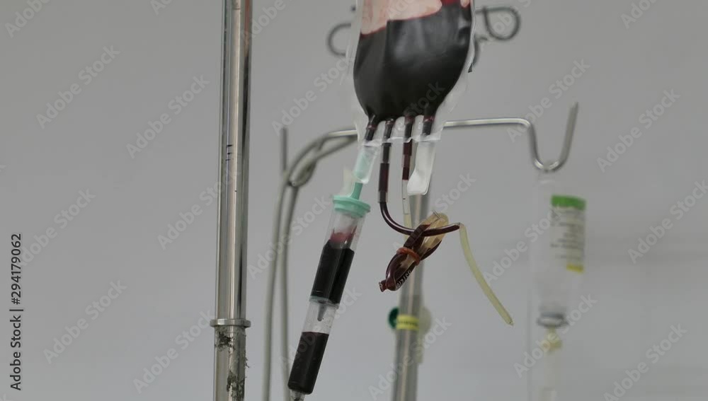 Blood bag hanging on the tripod during blood transfusion therapy for ...