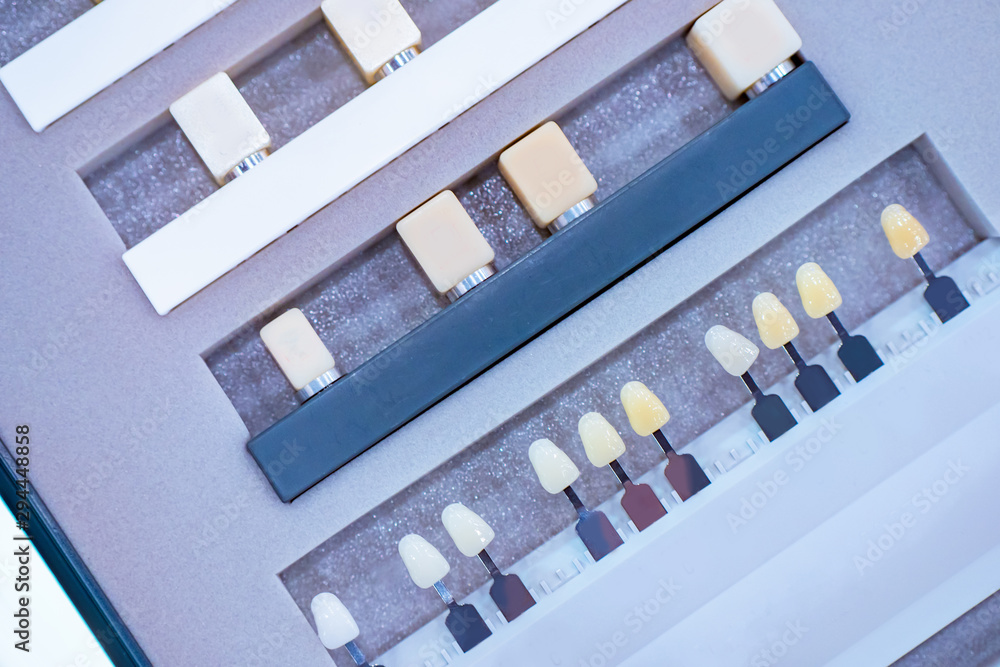 Tooth veneers. Manufactureof dental veneers. Set of colors of dental ...