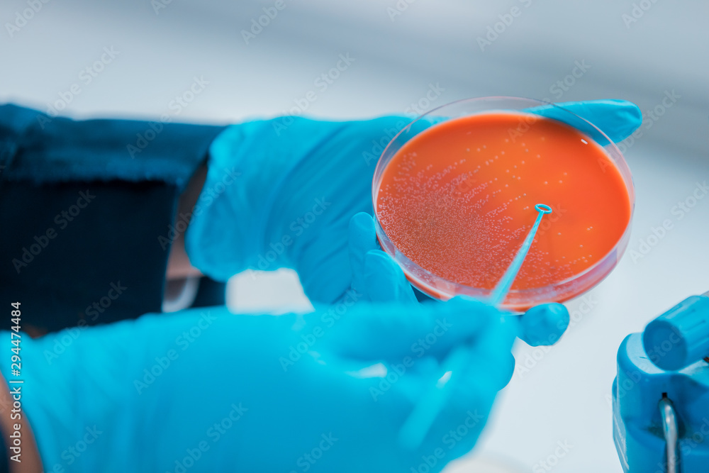 Scientist examining bacterial culture plate in a microbiology research ...