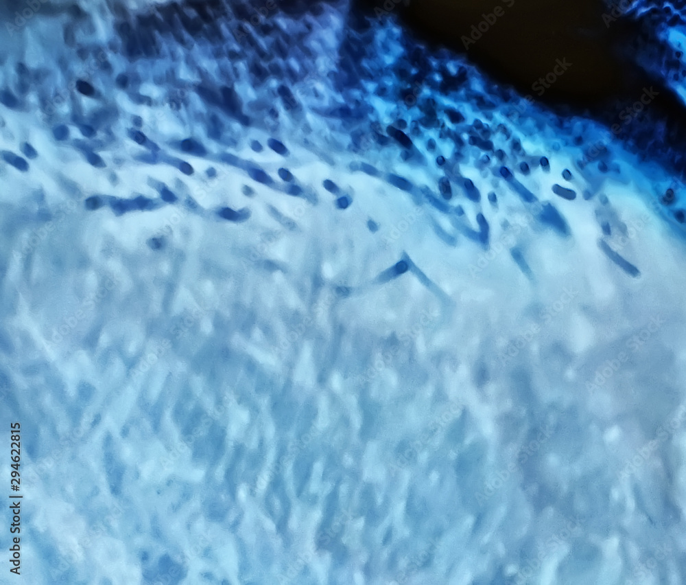 bacteria or cells under the microscope. Multiplication of bacteria or ...