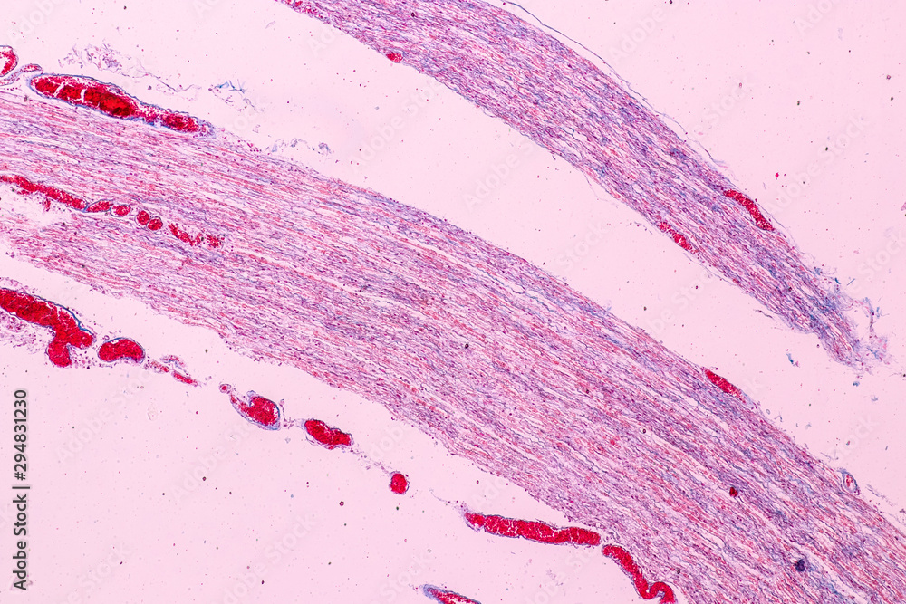 Education anatomy and Histological sample Touch corpuscles in skin ...