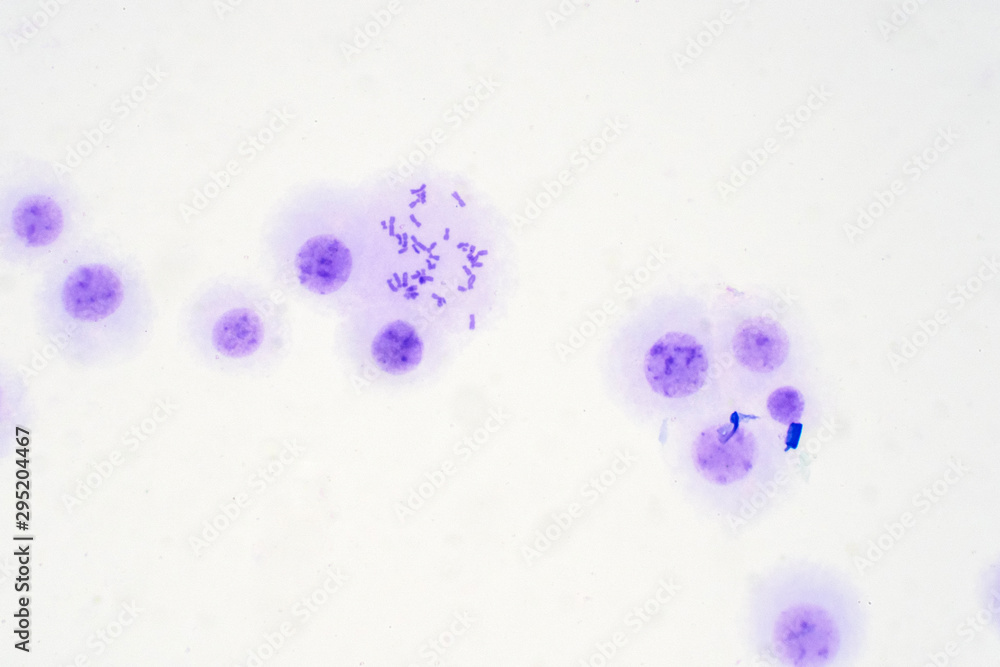 Human chromosomes from blood under microscope view. Stock Photo | Adobe ...