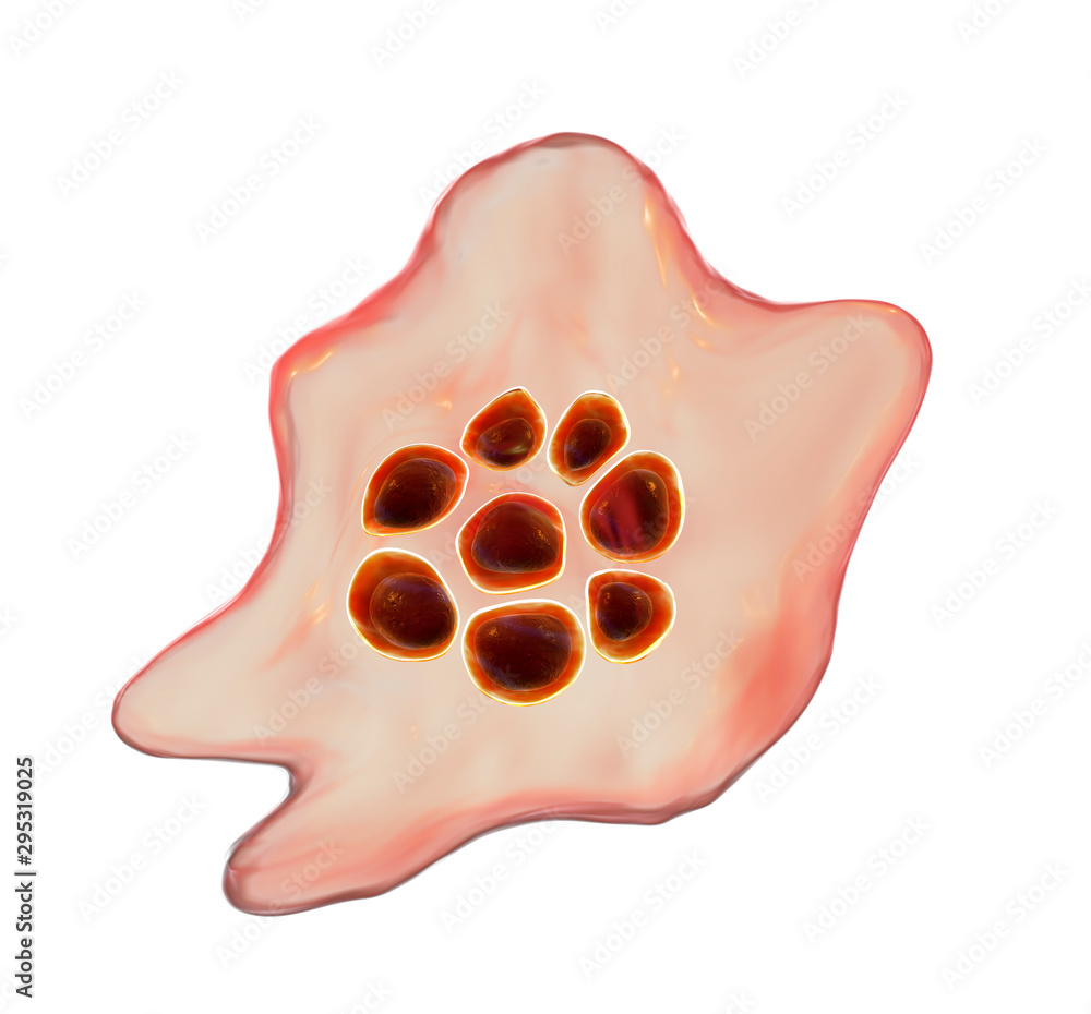 The malaria-infected red blood cell. 3D illustration showing malaria ...