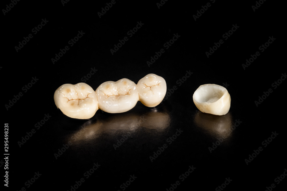 ceramic crowns of human teeth closeup macro isolate on black background ...