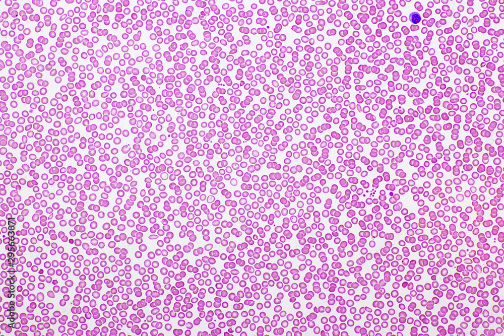 Red blood cells and platelet in blood smear, Wright-Giemsa stain ...
