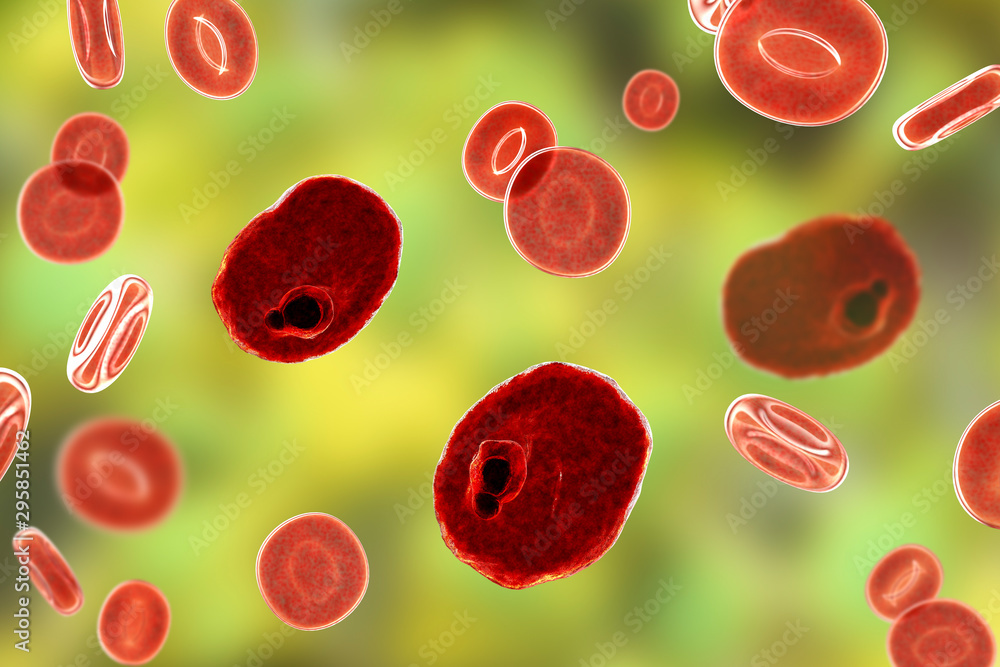 The malaria-infected red blood cells. 3D illustration showing malaria ...
