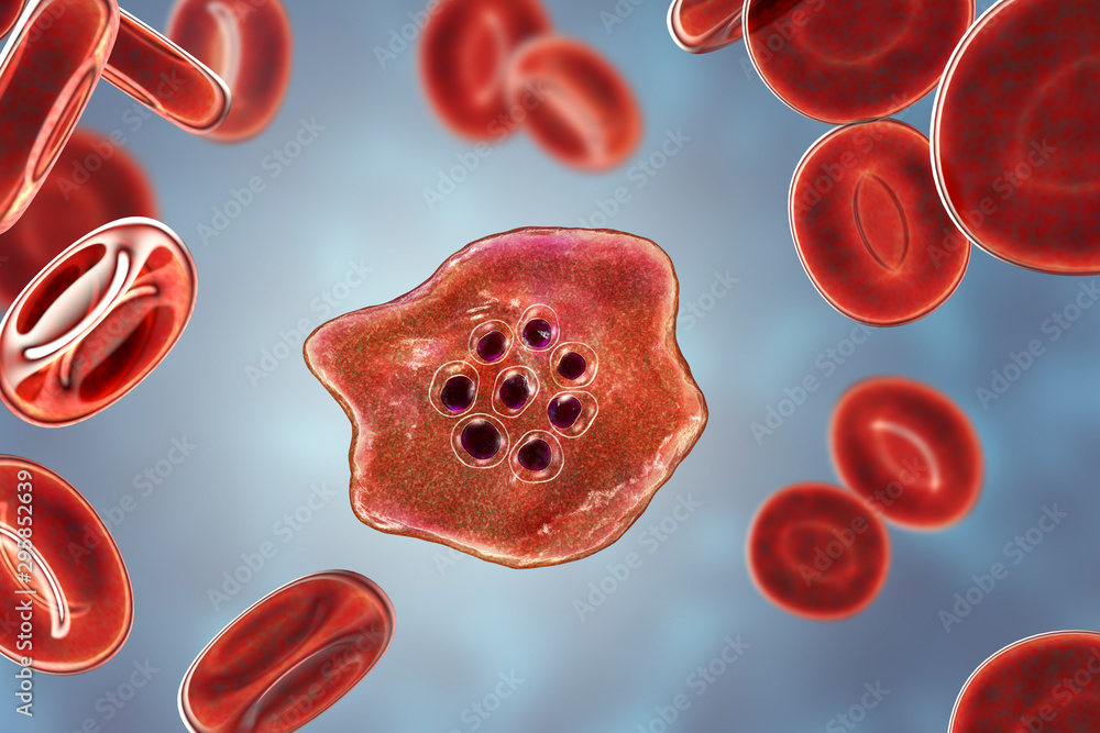 The malaria-infected red blood cell. 3D illustration showing malaria ...