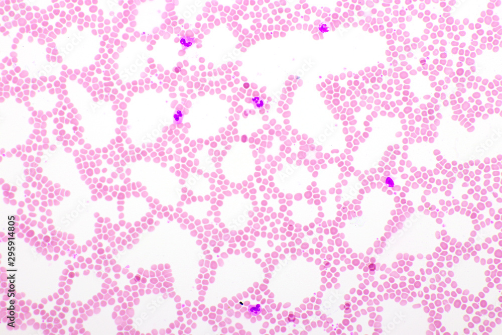 Platelets Microscope