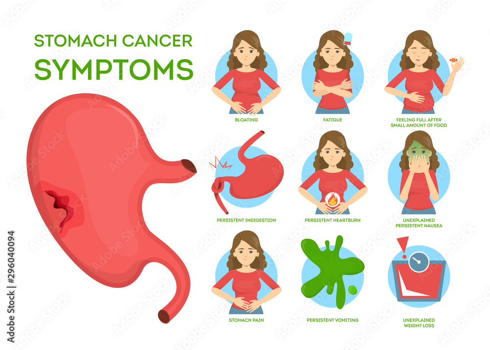 Stomach cancer signs and symptoms. Weightloss and appetite Stock Vector ...