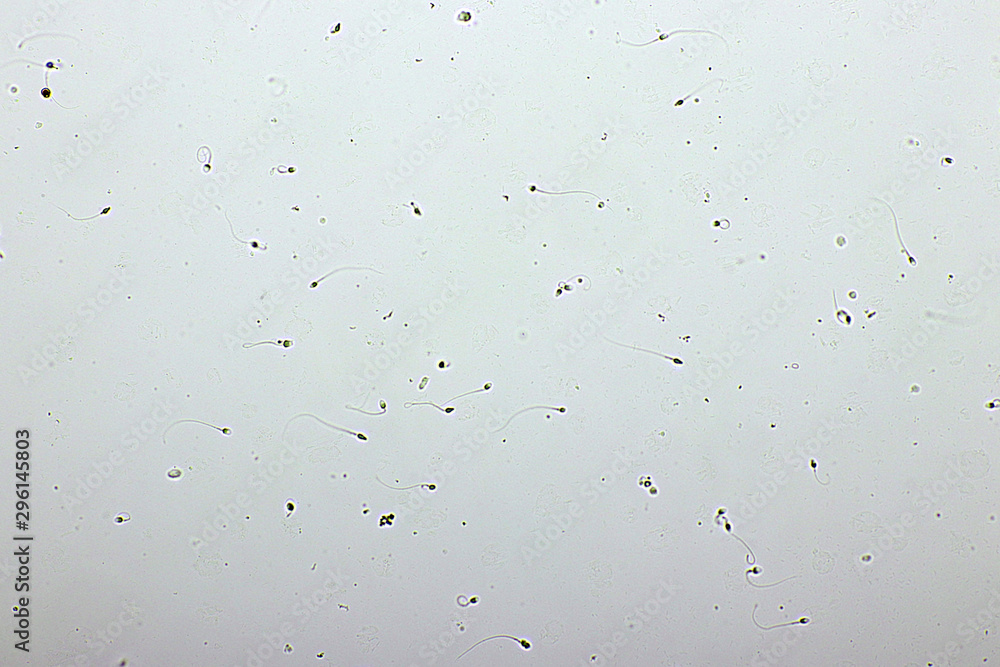 Sperm cells or spermatozoa in semen, analyze by microscope, 400x Stock ...