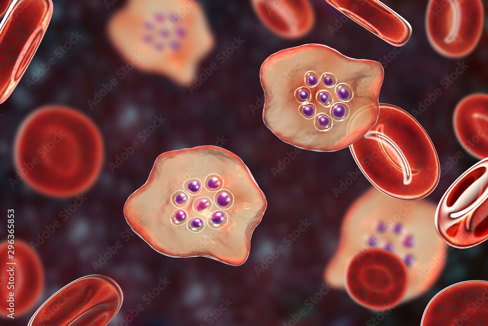 The malaria-infected red blood cells. 3D illustration showing malaria ...