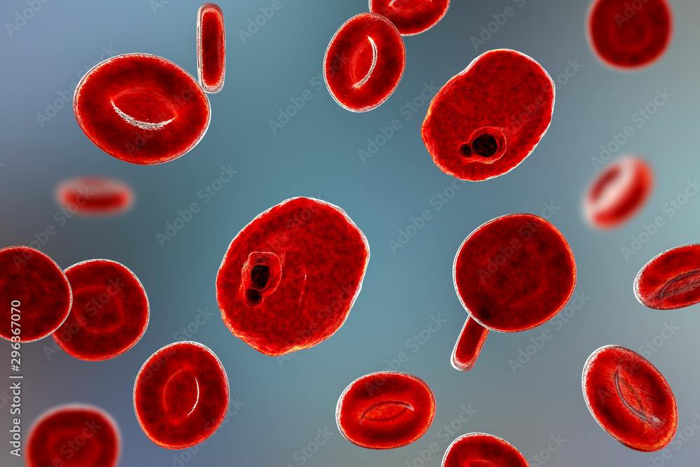 The malaria-infected red blood cells. 3D illustration showing malaria ...