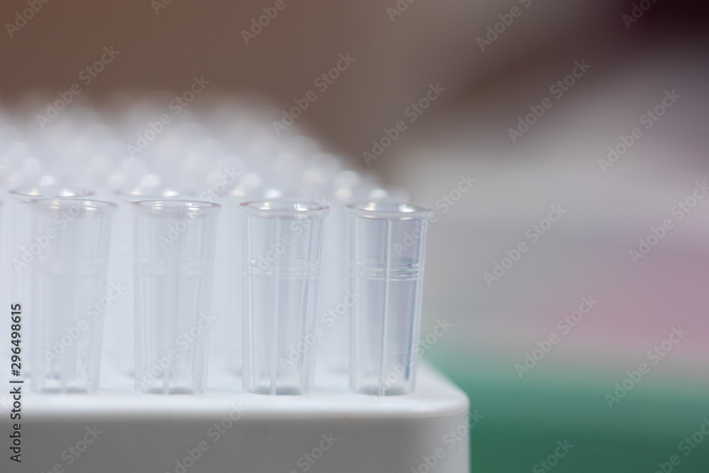 Polymerase Chain Reaction (PCR) and Agarose gel electrophoresis is a ...