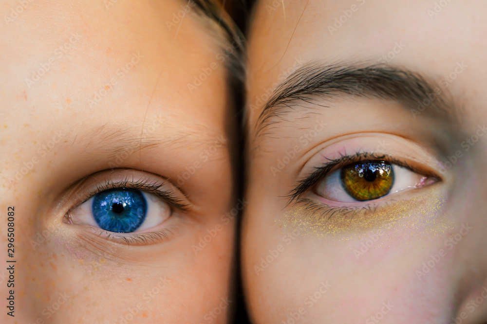 two girls with different eyes touch their cheeks, photo near. The first ...