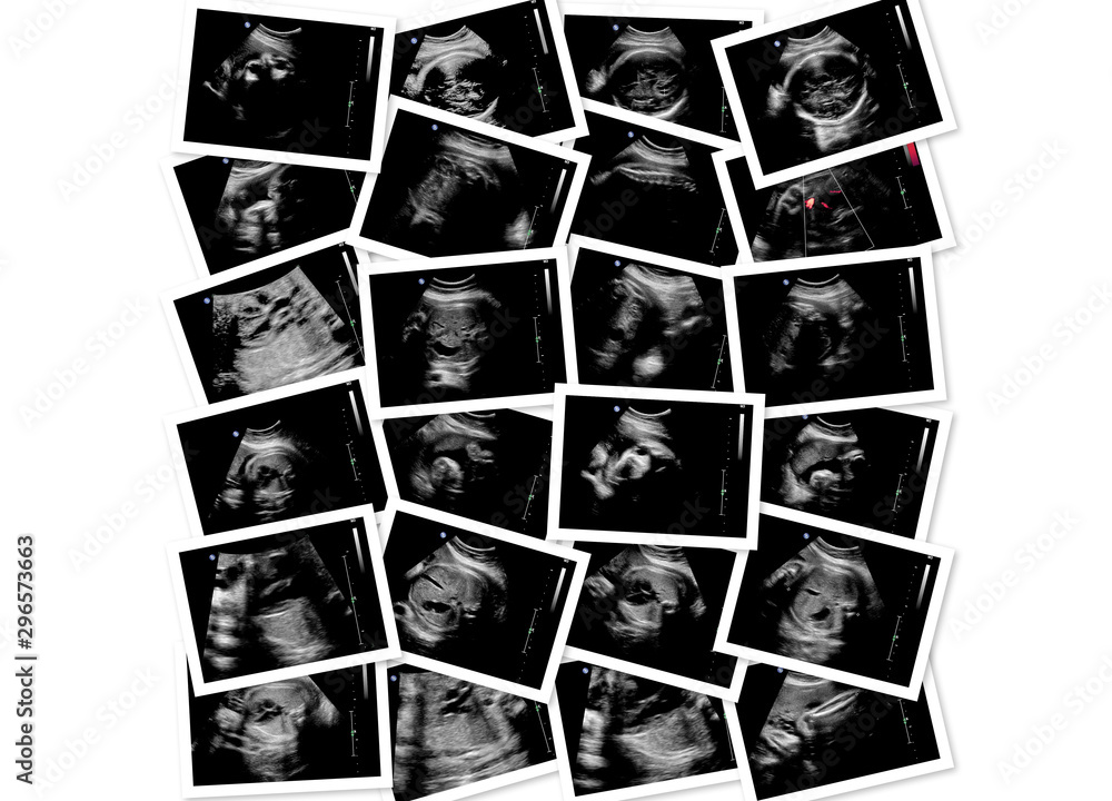 Collection of images from ultrasound scan examination Stock Photo ...