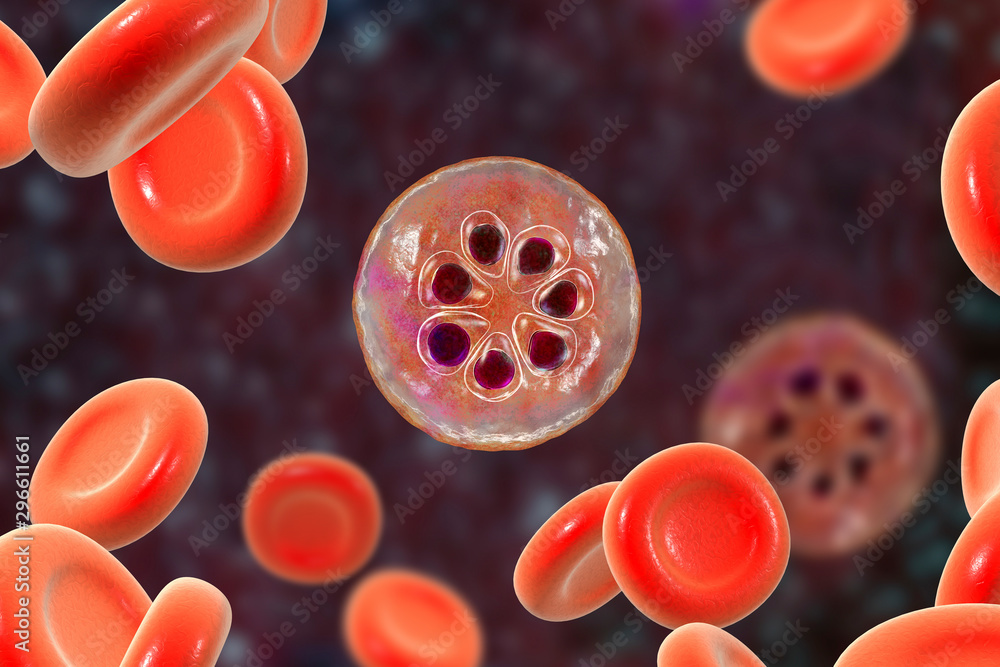 The malaria-infected red blood cell. 3D illustration showing parasite ...
