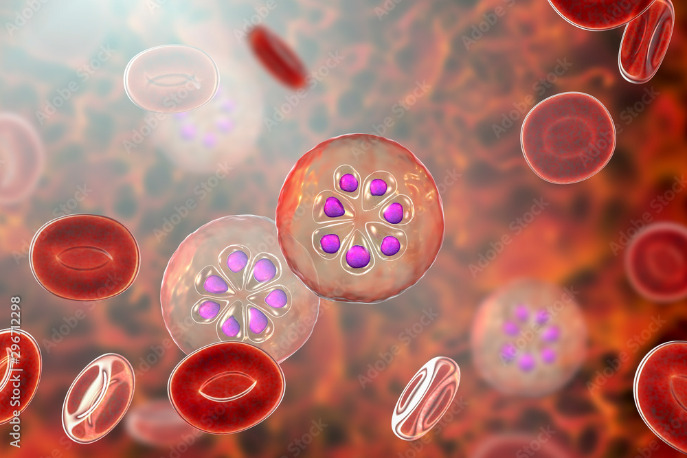 The malaria-infected red blood cell. 3D illustration showing parasite ...