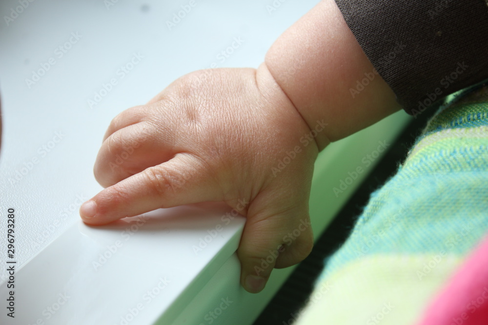 Polydactyly Preaxial, Polydactyly on human; rare abnormal ...