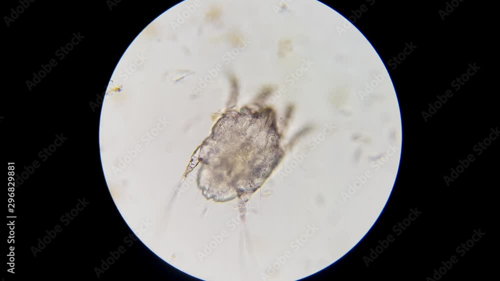 Otodectes cynotis, also known as an ear scabies. Ear swab of a cat's ...