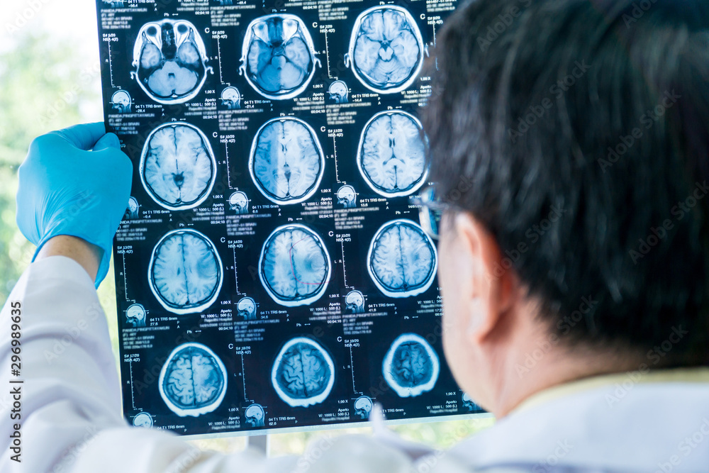 Male doctor looking at the MRI scan film of the human brain. Stock ...