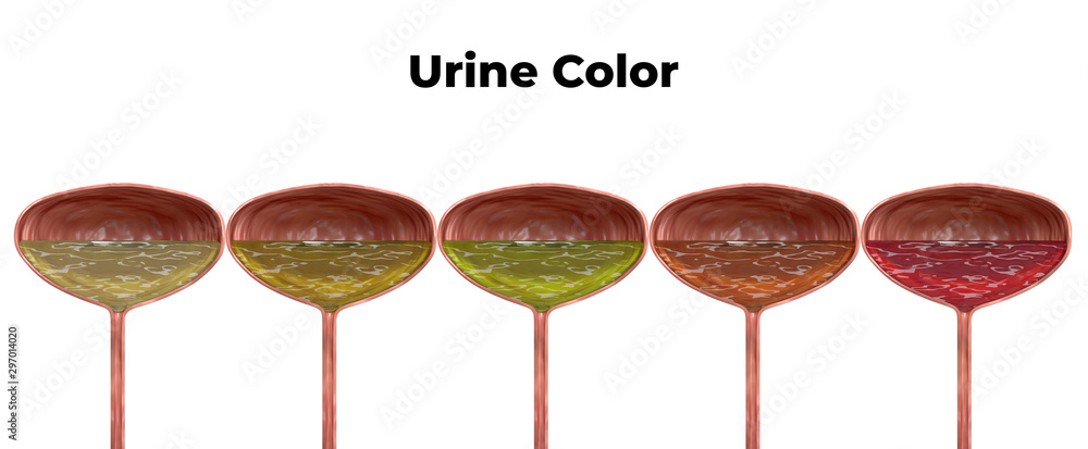 Bladder isolated on white background with urine color grading. Urine ...