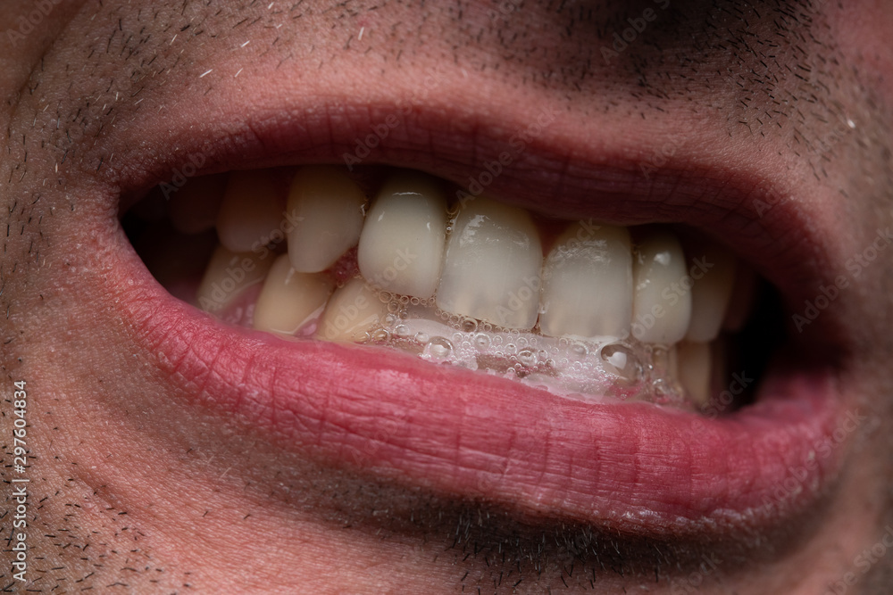 Image of man with open mouth, showing teeth foto de Stock | Adobe Stock