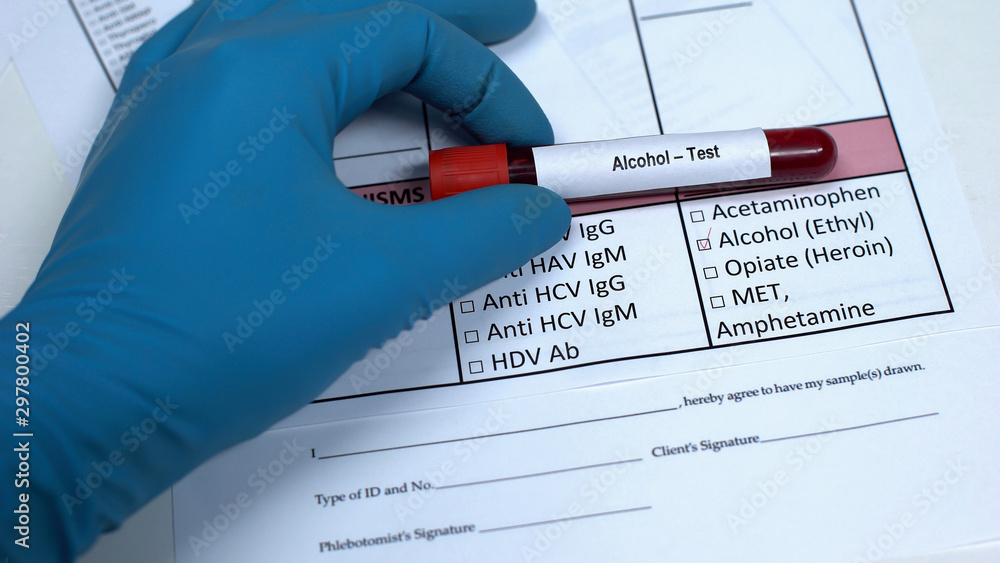 Alcohol test, doctor showing blood sample in tube, lab research, health ...