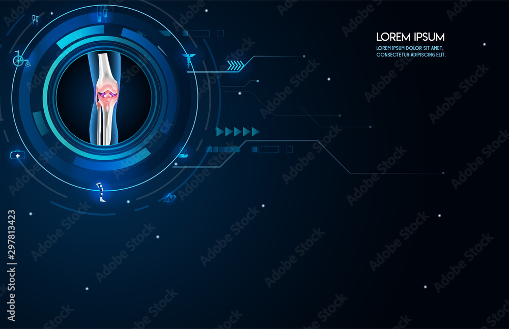 Medical orthopedic abstract background. Treatment for orthopedics ...