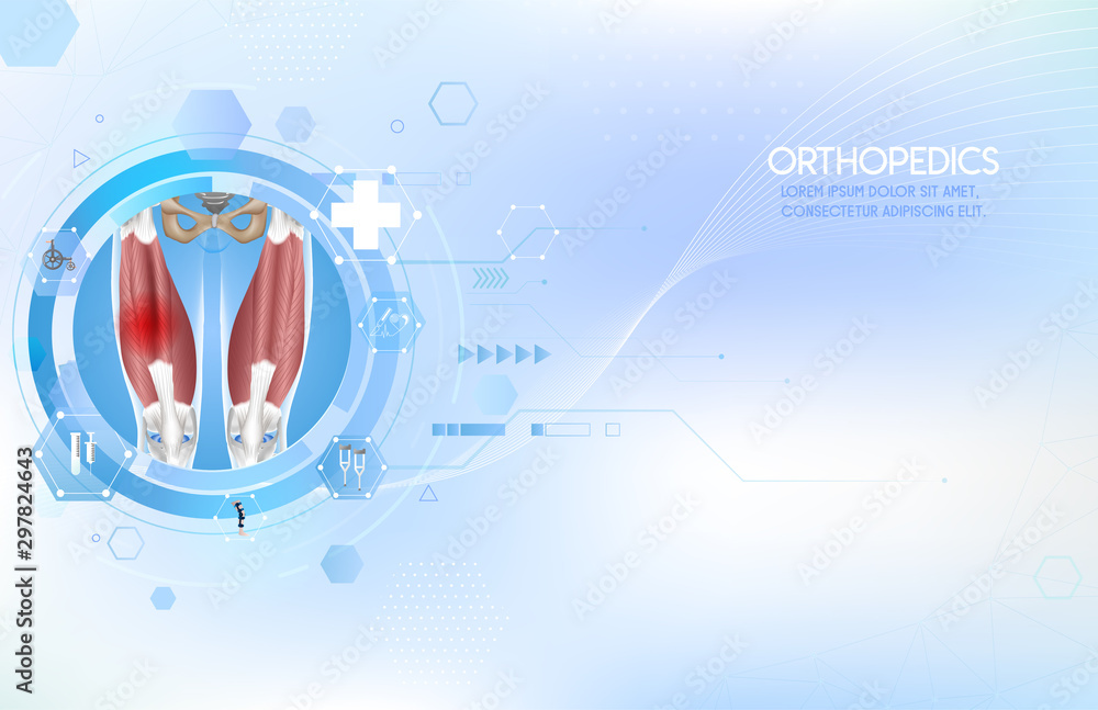 Medical orthopedic abstract. Treatment for orthopedics traumatology of ...