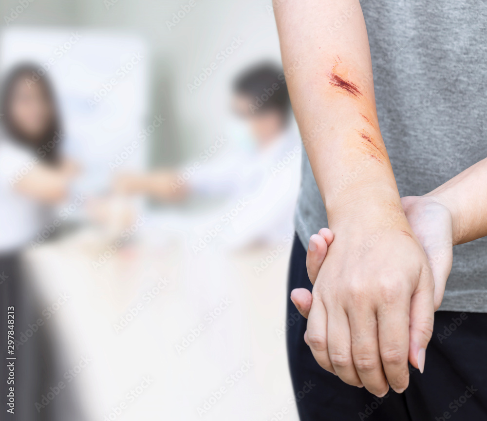 The wound form scabs on hand and arm. The wound happen during woman ...