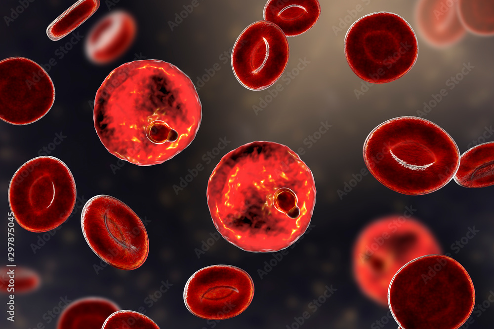 The malaria-infected red blood cell. 3D illustration showing parasite ...