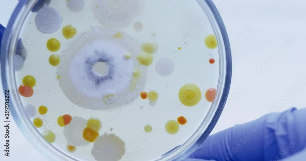 Bacterial test for the purity of drinking water. Closeup of a petri ...