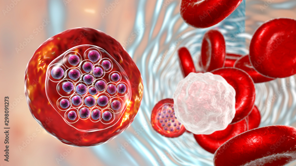 The malaria-infected red blood cells. 3D illustration showing parasite ...