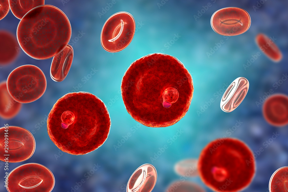 The malaria-infected red blood cell. 3D illustration showing parasite ...