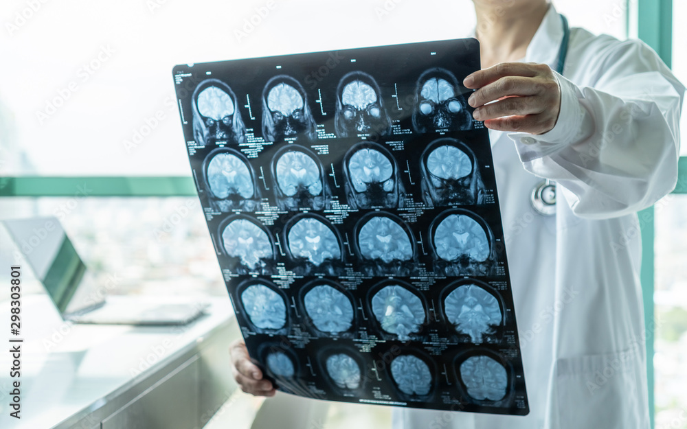 Brain disease diagnosis with medical doctor seeing Magnetic Resonance ...