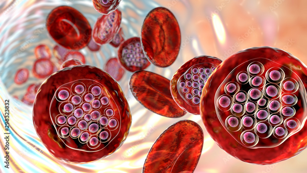 The malaria-infected red blood cells. 3D illustration showing parasite ...