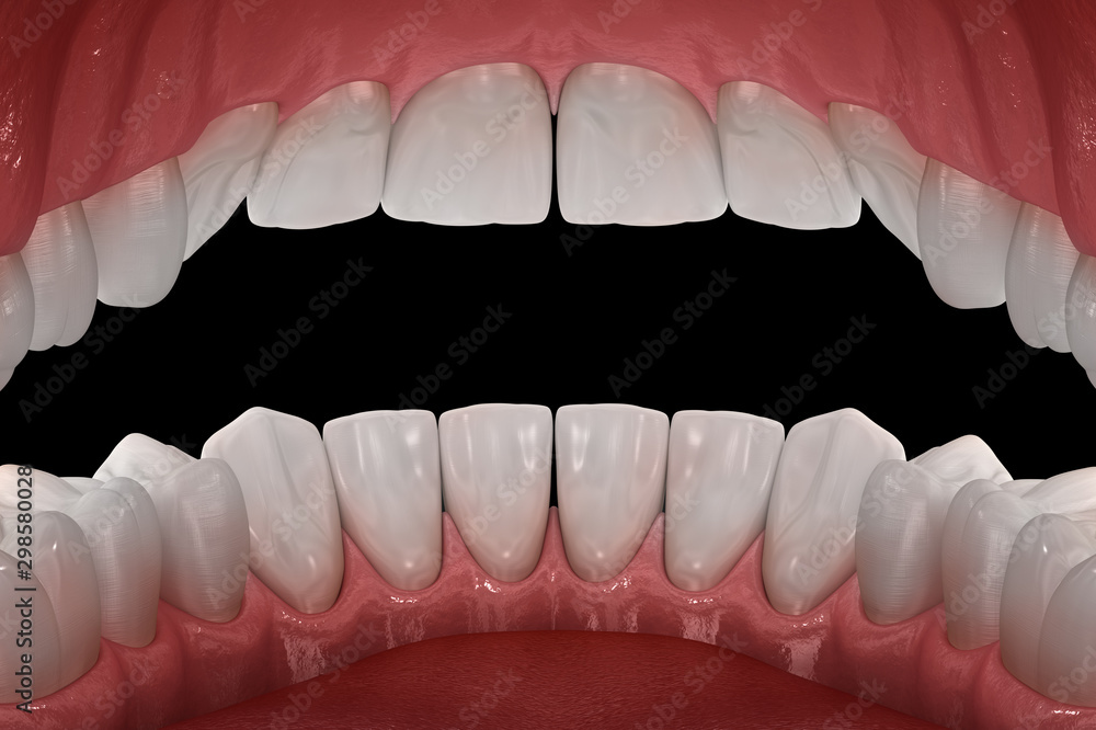 Healthy human teeth with normal occlusion, view form inside. Medically ...