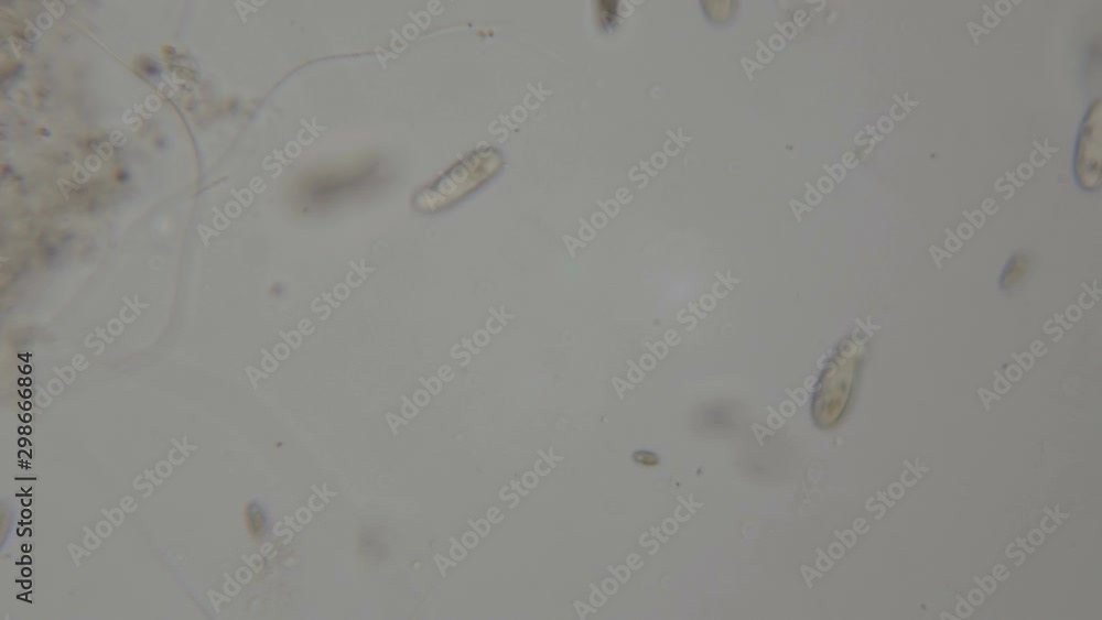Vidéo Stock Motion of single-celled animals (infusoria) under ...