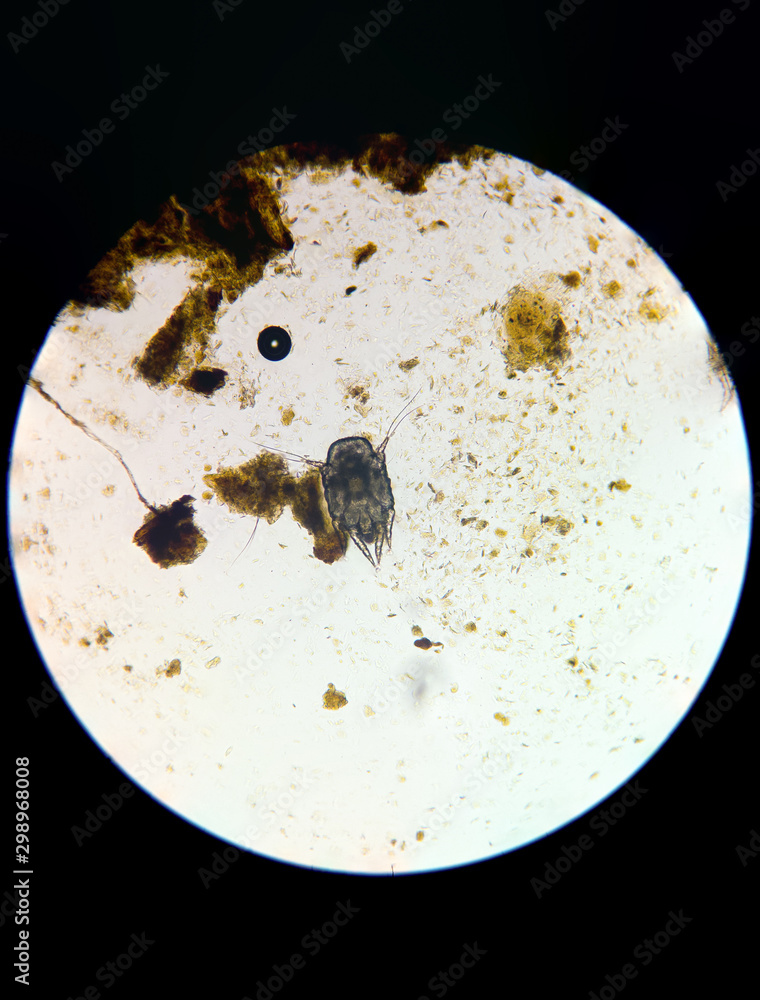 otodectes cynotis also known as ear mite. Taken from ear of homeless ...