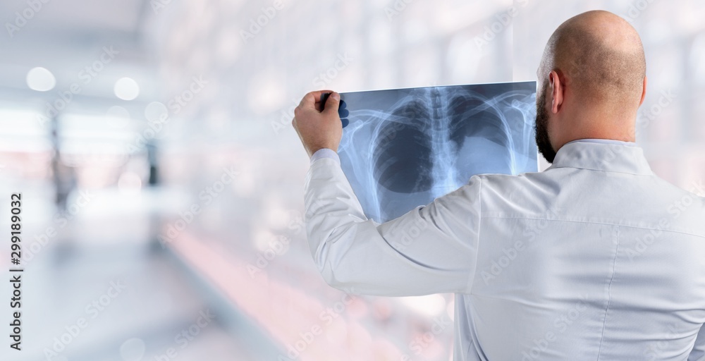 lung radiography concept. radiology doctor examining at chest x ray ...